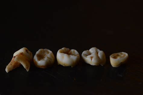 Odontophobia Dentophobia Odontophobia Is A Fear Of Teeth Flickr