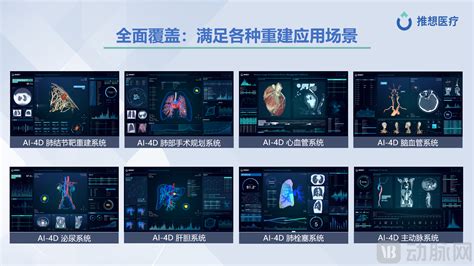 Cmef收官 推想医疗，用ai照亮未来 动脉网
