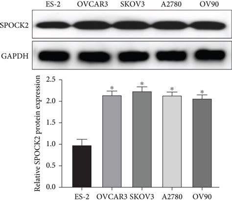 Spock2 Was Upregulated In Oc Tissues And Cells A The Expression