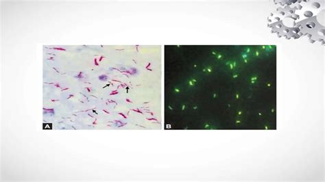Sputum Culture In Tuberculosis Acid Fast Bacilli Pptx