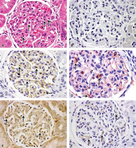Hematoxylin And Eosin H E Progressive Stain Histology
