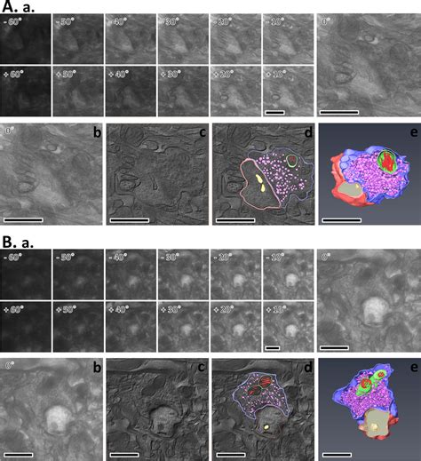 Electron Tomography Of Presynaptic Terminals In Mice Cerebral Cortex