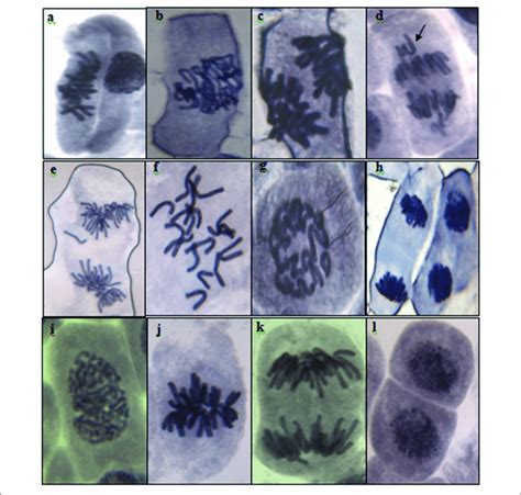 Different Chromosomal Aberration Induced By Pulp Paper Mill Effluent Download Scientific