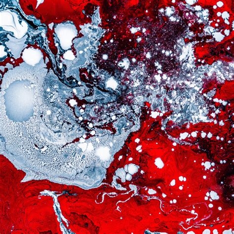 Trombose Venosa Profunda o que é e como prevenir Vena