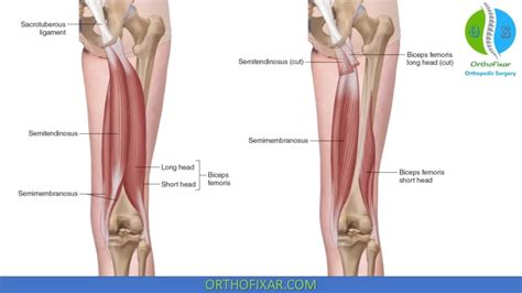 Hamstring Flexibility Explained Easily Orthofixar