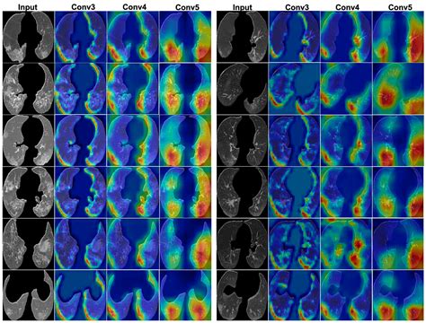 How To Reduce Training Parameters In Cnns While Keeping Accuracy 99 By Sabrina Göllner