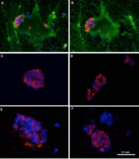 Binding Of Human Igm And Igg Antibody To Pig Islets Xenogeneic Ab Download Scientific