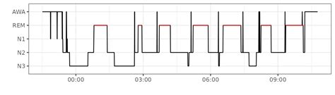 spindles detection and analysis rsleep