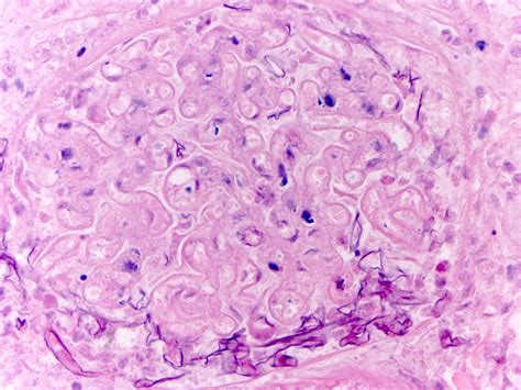 Mucor Histology