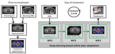 Development Of A Deep Learning Toolkit For Mri Guided Online Adaptive Radiotherapy Lmu Art Lab