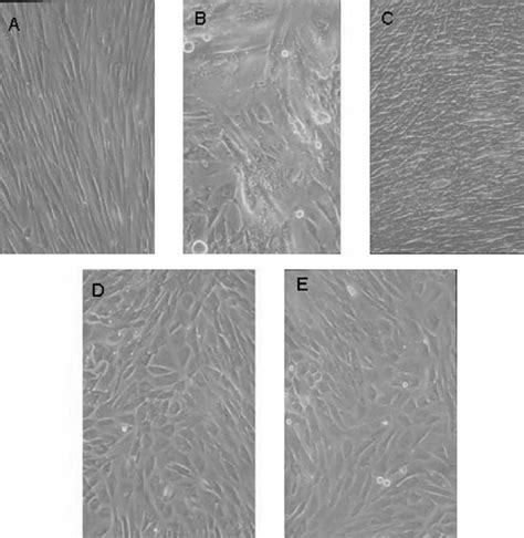 Decidualization Of Endometrial Stromal Cells By Placental Steroid