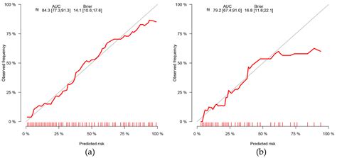 Predicting Extrathyroidal Extension In Papillary Thyroid Carcinoma Using A Clinical Radiomics