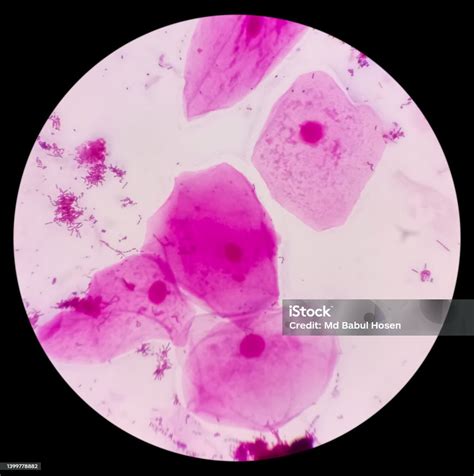 전립선 얼룩 그램 염색 현미경 40x는 상피 세포 그람 양성 Diplococci 및 그람 음성 막대를 보여줍니다 0명에 대한 스톡 사진 및 기타 이미지 Istock