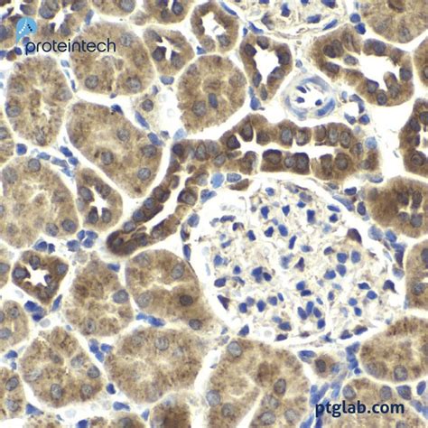 Hans Lundberg On Linkedin Immunohistochemistry Ihc Antibody