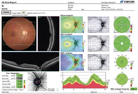 Crstoday The Next Generation Automated Oct And Fundus Imaging System