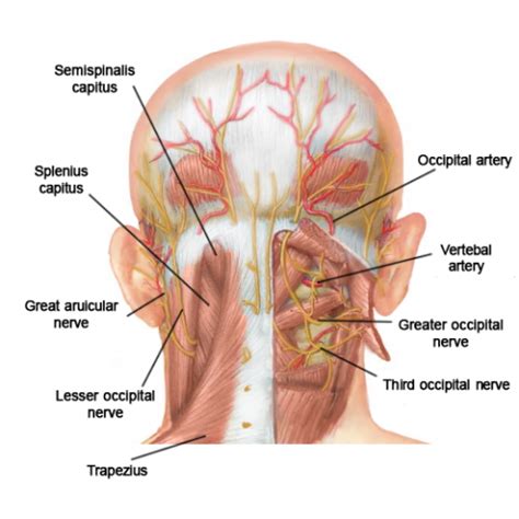Occipital Nerve Ablation Pain Spa
