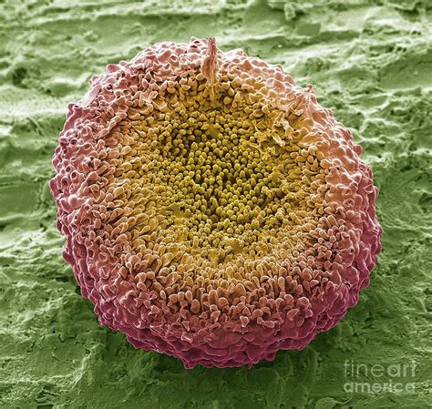 Ascocarp Photograph By Steve Gschmeissnerscience Photo Library Pixels