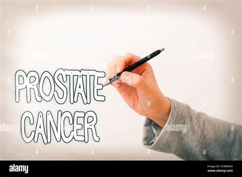 Text Sign Showing Prostate Cancer Business Photo Text Development Of
