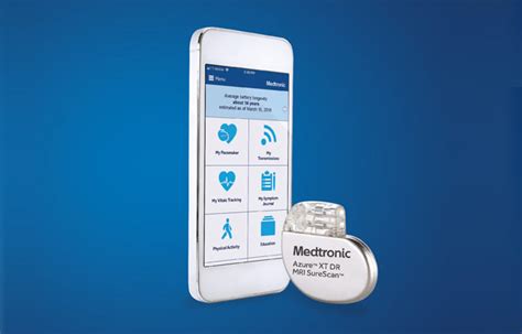 Medtronics New Carelink Express System For Quick Review Of Cardiac