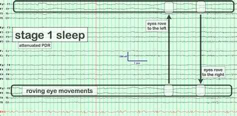 Eye Flutter Roll At Kate Terry Blog