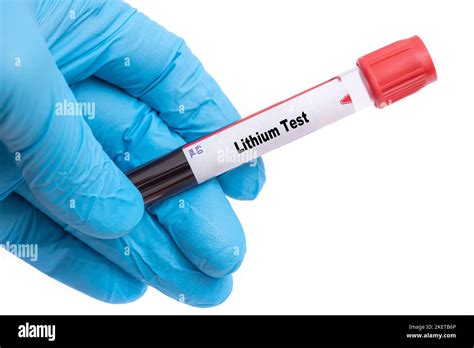 Lithium Test Medical Check Up Test Tube With Biological Sample Stock Photo Alamy