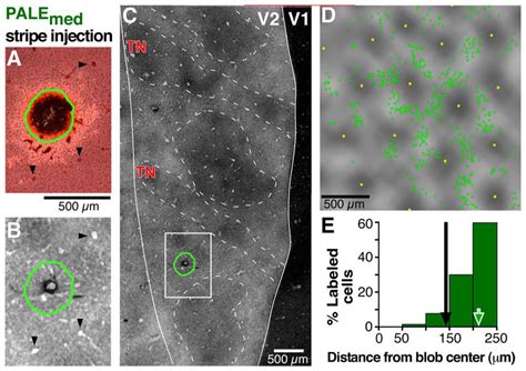 V2 Pale Stripes Receive Projections From Co Interblobs Case 282 L A