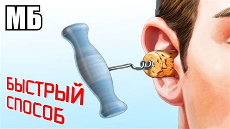 Заложило ухо | Как быстро и легко избавится от ушной пробки | Лайфхак ...