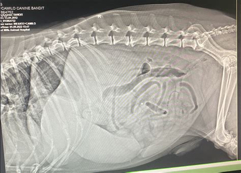 Possible Cranial Csf Leak Pics R Csfleaks