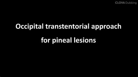 Occipital Transtentorial Approach For Pineal Lesions Ispn Library