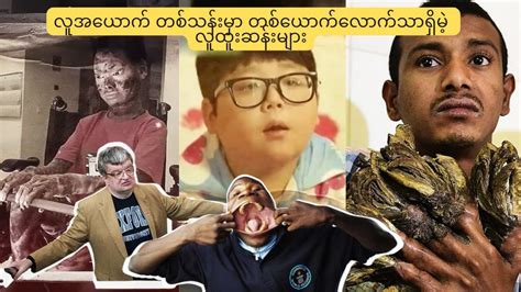 လူအယောက် တစ်သန်းမှာ တစ်ယောက်လောက်သာရှိမဲ့ လူထူးဆန်းများ Youtube