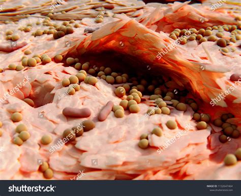 Atopic Dermatitis Over 1571 Royalty Free Licensable Stock