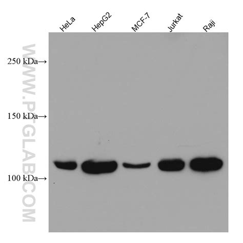 Ldlr Antibody 66414 1 Ig Proteintech