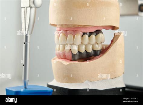 Articulator Dental Occlusion At Tasha Hyman Blog