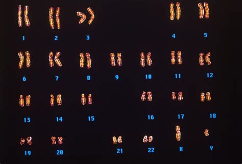 Normal Male Chromosomes Photograph By Cnri