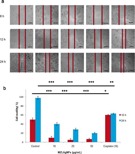 A Cell Migration Assay Showed That Mzlagnps Inhibited The Migration Of