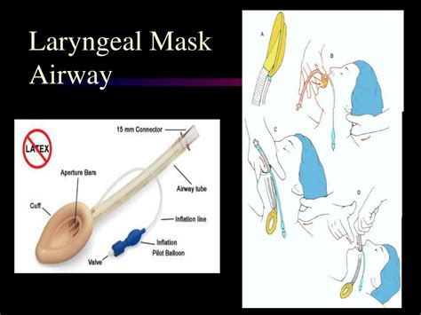 Ppt Difficult Airway Management Powerpoint Presentation Free