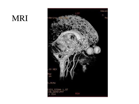 Ppt Mri Powerpoint Presentation Free Download Id9234187