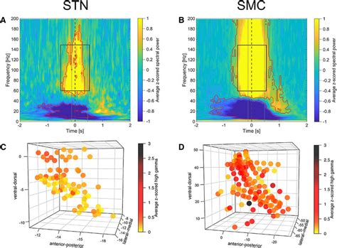 Stn And Sensorimotor Cortex Smc Show Speech Production Related Download Scientific Diagram