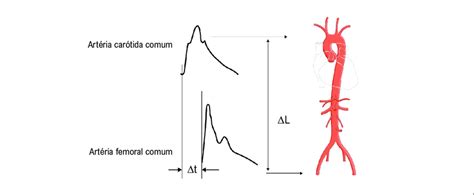 Medida da velocidade da onda de pulso carotídeo femoral o método Download Scientific