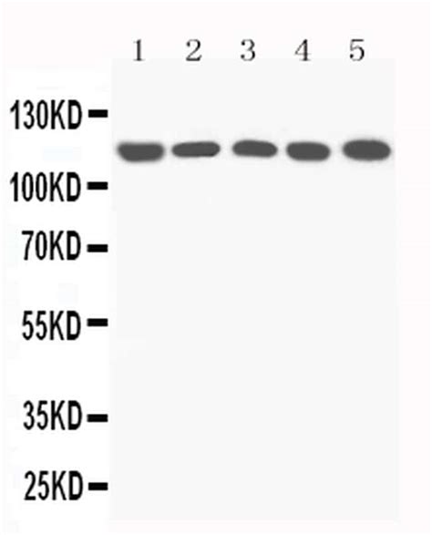 Complement C5a Antibody PA5 78891
