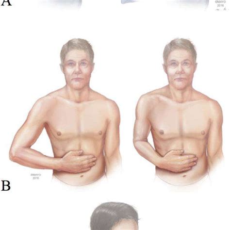 Special Tests For The Shoulder Exam Sports Medicine Review