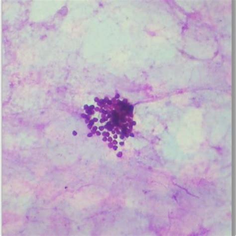 Budding Yeast Photomicrograph Showing Budding Yeast Form Of Fungus In