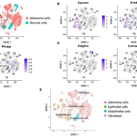 Clustering Analysis Based On ScRNA Seq Data Of CD45 Marker Flow Sorted