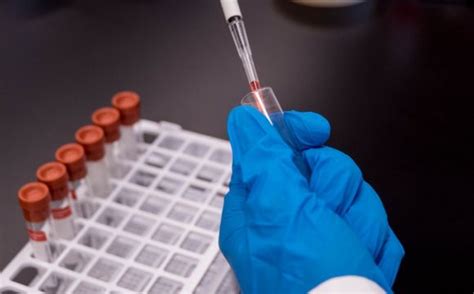 How Spin Columns Optimize Nucleic Acid Purification Biomall Blog