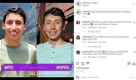 Egan Bernal nariz cambio físico hoy del ciclista colombiano Canal 1
