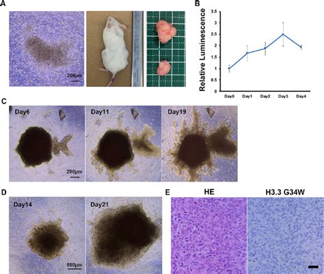 Establishment Of PDO And ODX Models Of OICI MGCT A Morphology Download Scientific