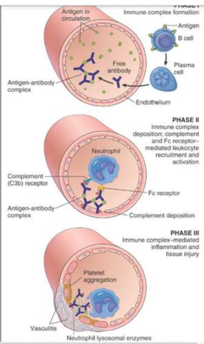 Cv Pathology 04 Flashcards Quizlet Cv Pathology 04 Flashcards Quizlet