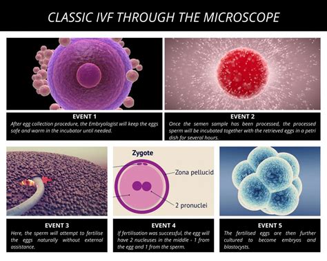 Ivf Vs Icsi Kl Fertility Centre