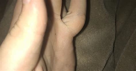Finger Album On Imgur