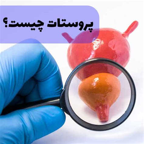 پروستات چیست و بیماری‌های آن کدامند؟ دکتر حسن نیرومند جراح و فوق تخصص